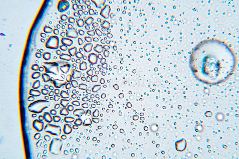 Biological Fluid at a Crime Scene Under a Microscope As Evidence of a ...
