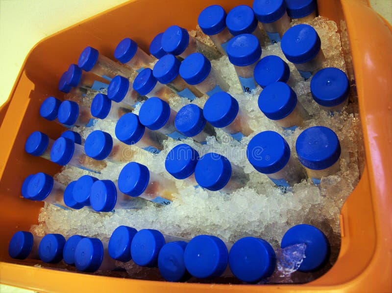Biological Samples stock image. Image of laboratory, lids - 30595581