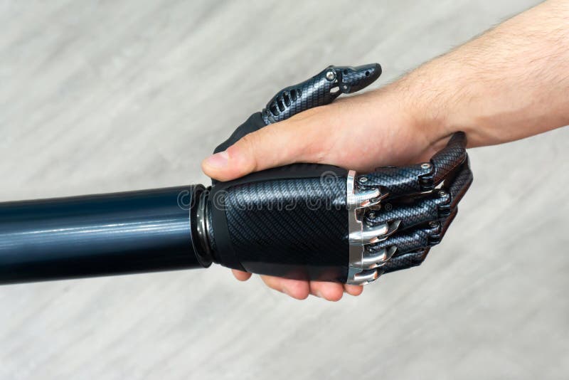 Bionic Arm. Modern Prosthetic Limbs Stock Image - Image of engineering ...