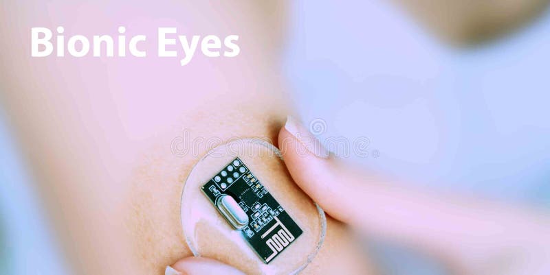 Bionic Eyes Implantable Electronic Medical Devices Concept Stock Image ...