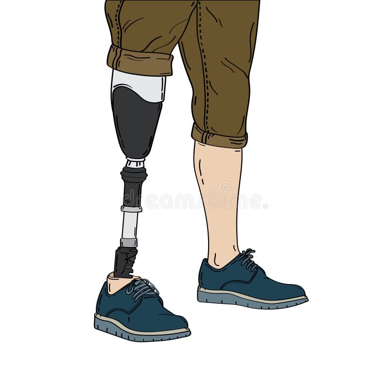 Bionic Prosthesis of a Leg. Stock Illustration - Illustration of assist ...