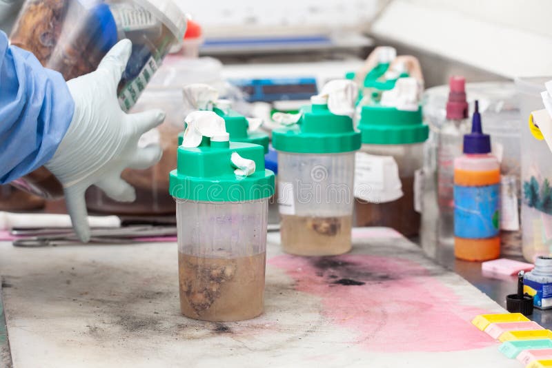 Biopsy Samples Being Processed at the Pathology Laboratory To Be ...