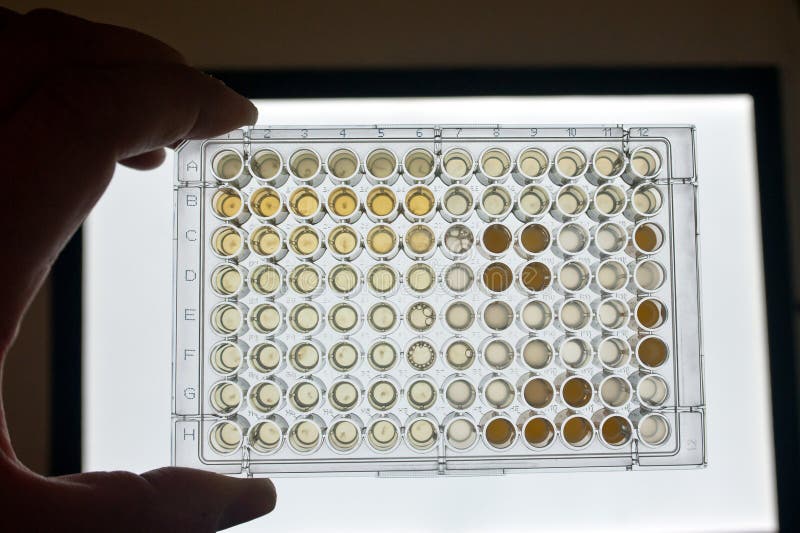 Biotech Samples in Plastic 96 Well Plate Stock Photo - Image of hand ...