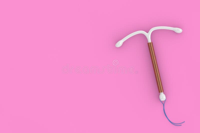 Copper Iud