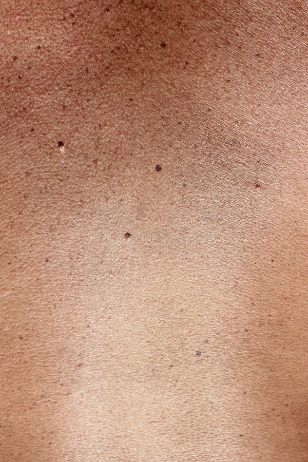 246 Moles Texture Stock Photos - Free & Royalty-Free Stock Photos from ...