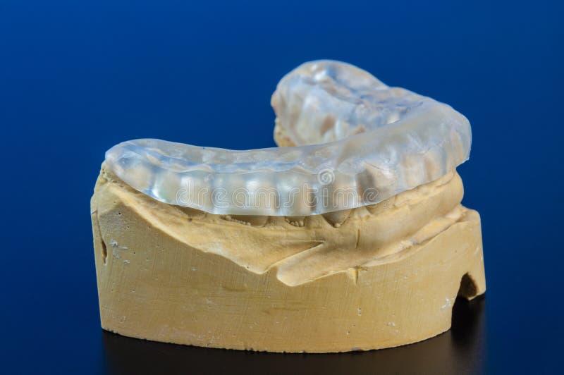 Bite stock image. Image of occlusal, prosthetic, artificial - 73864221