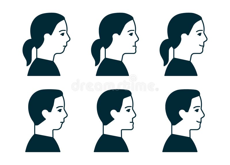 Bite Normal Jaw and Malocclusion, Face Man an Woman in Profile Set ...