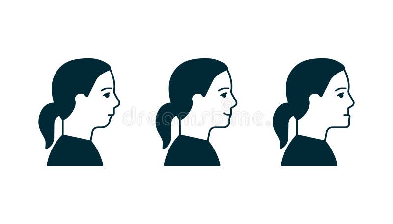 Bite Normal Jaw and Malocclusion, Face Woman in Profile Set. Dental ...