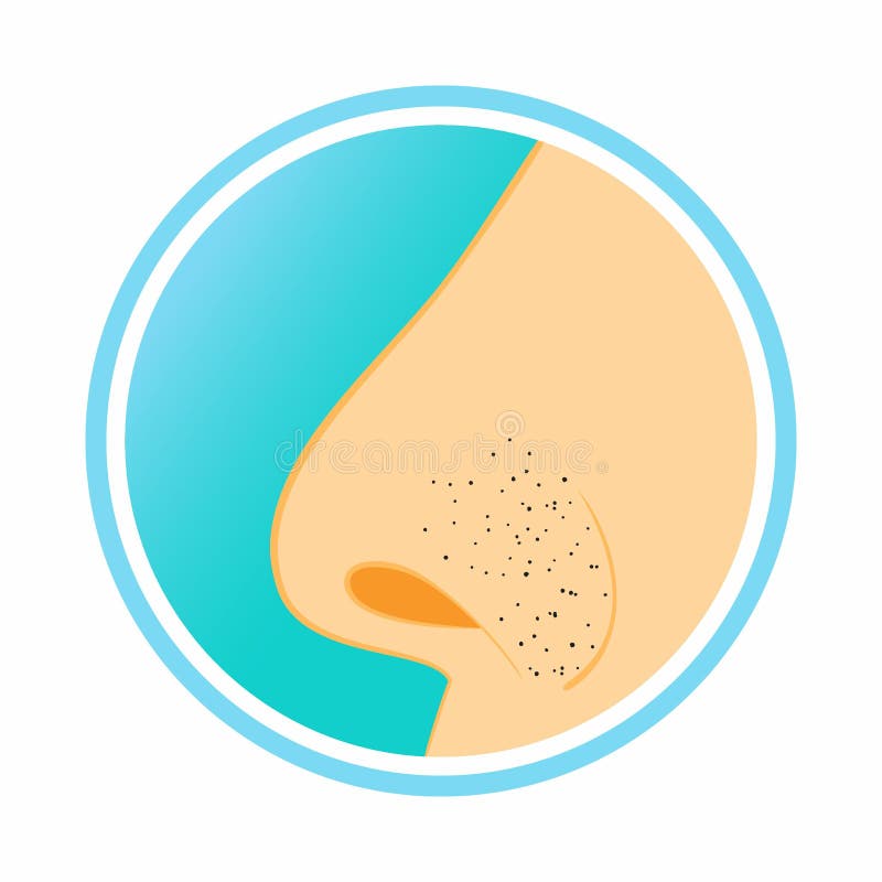Black Dots on Skin Nose. Vector Illustration Stock Vector ...