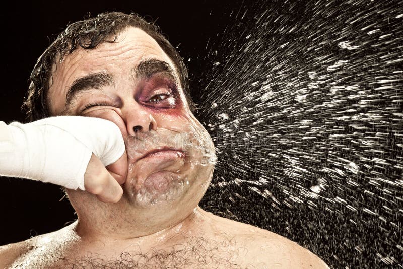 Black Eye Wound Boxer Spit Due Big Punch Hit Portrait Stock Image ...