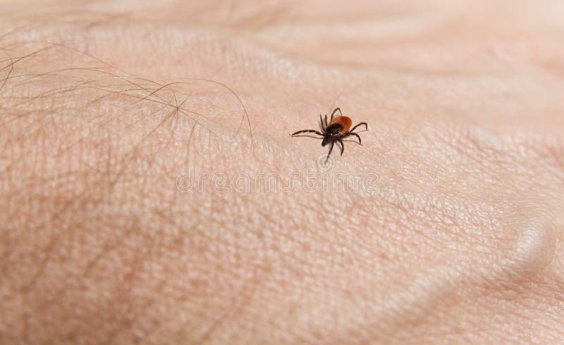 Black Legged Deer Tick Macro Stock Photo - Image of hand, macro: 34431288