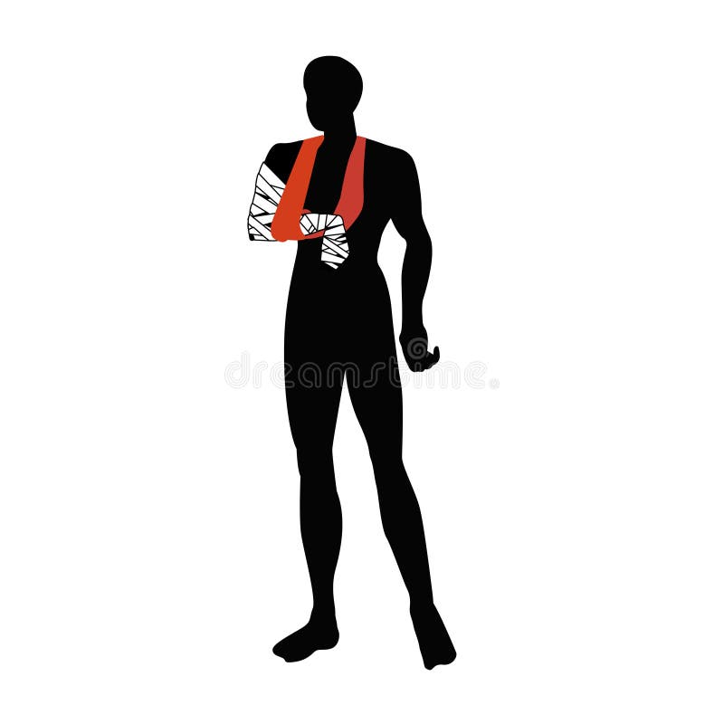 Arm Splint Stock Illustrations – 283 Arm Splint Stock Illustrations ...