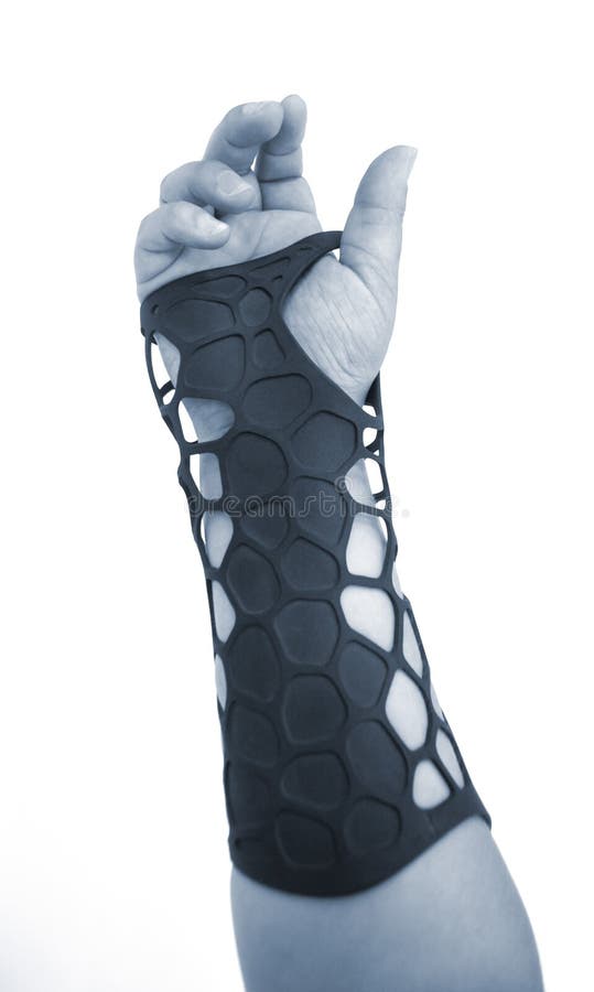 111 3d Printed Arm Stock Photos - Free & Royalty-Free Stock Photos from ...