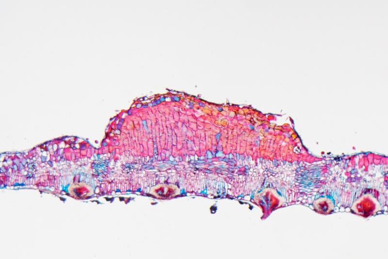 Black Rust, Puccinia Graminis, on a Barberry Leaf Under the Microscope ...