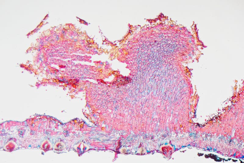 Black Rust, Puccinia Graminis, on a Barberry Leaf Under the Microscope ...