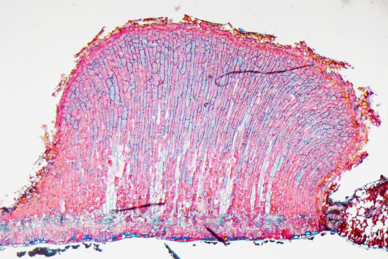Black Rust, Puccinia Graminis, on a Barberry Leaf Under the Microscope ...