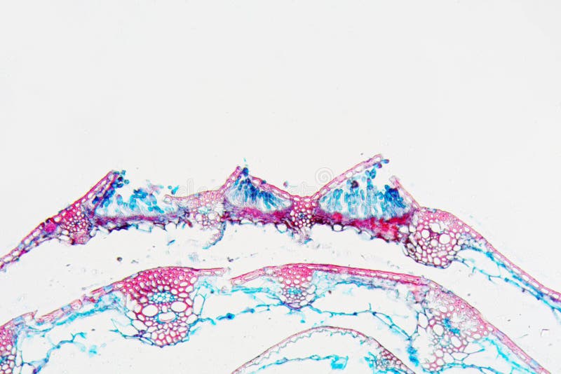 Black Rust, Puccinia Graminis, on a Wheat Leaf Under the Microscope ...