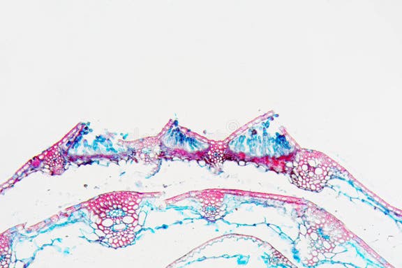 Black Rust, Puccinia Graminis, on a Wheat Leaf Under the Microscope ...