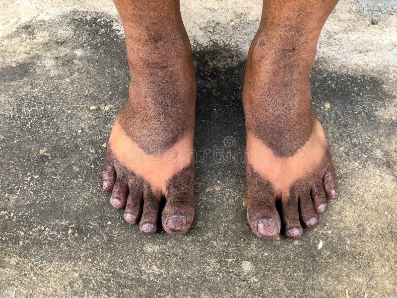 Black foot stock image. Image of shoes, healthy, paint - 110626399