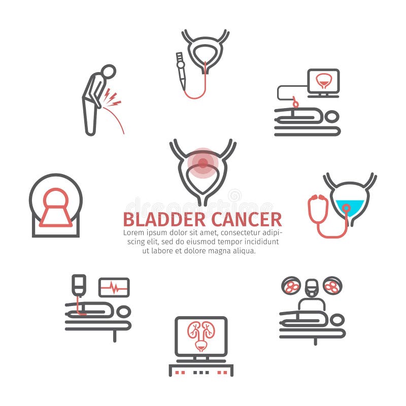 Prostate Cancer Symptoms Stock Illustrations 88 Prostate Cancer