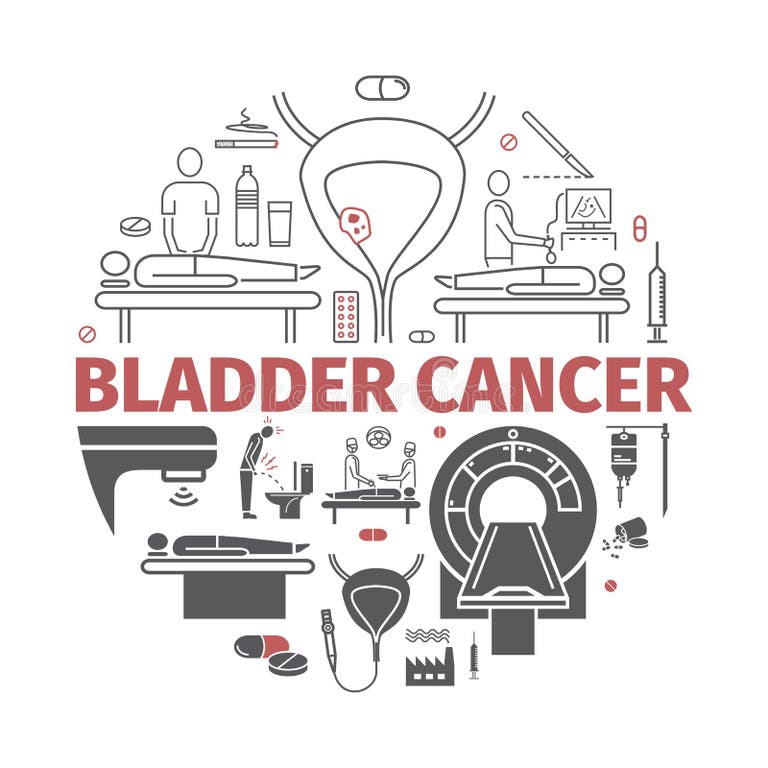 Prostate Cancer Signs Symptoms Stock Illustrations 18 Prostate Cancer