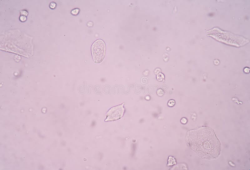 Squamous Epithelial Cells Under Microscope View For Education Hi Stock ...