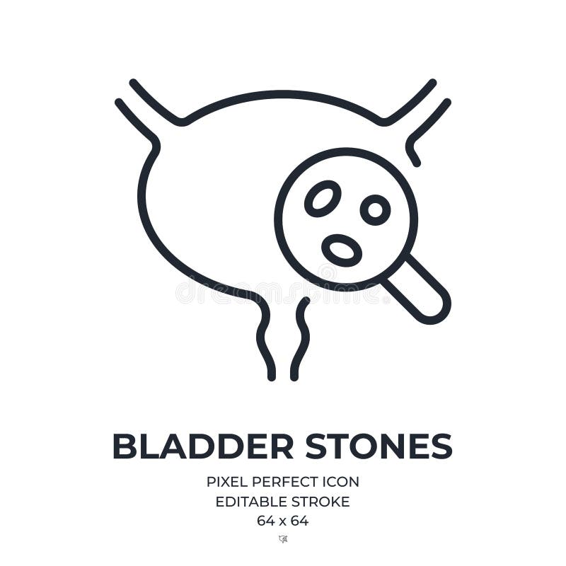 Stones in the Bladder. Two Big Stones Inside the Bladder Cavity and One ...