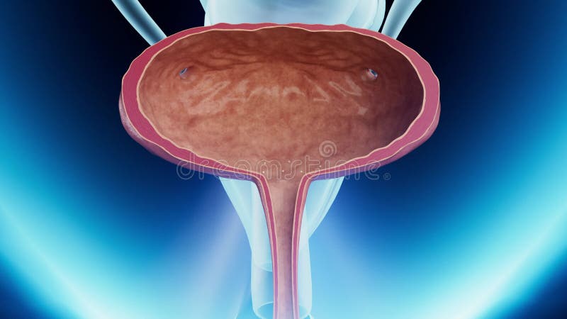 Bladder Stones, Process of Stone Formation in Urinary Tract Infection ...