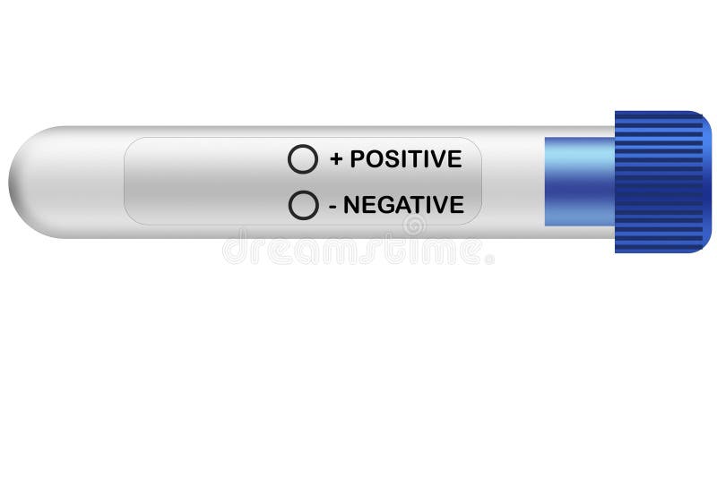 Blank Test Tube with Positive and Negative Selection Stock Illustration ...
