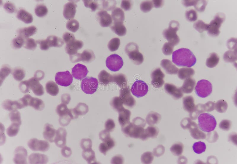 Abnormal Red Blood Cells Science Background Stock Photos - Download 87 ...