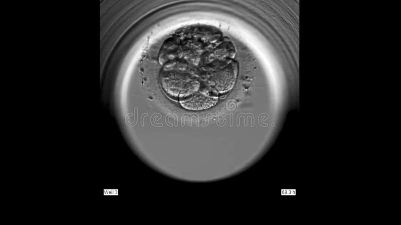 Blastocyst Formation Human Egg Fertility Cell Division Time Lapse Under ...