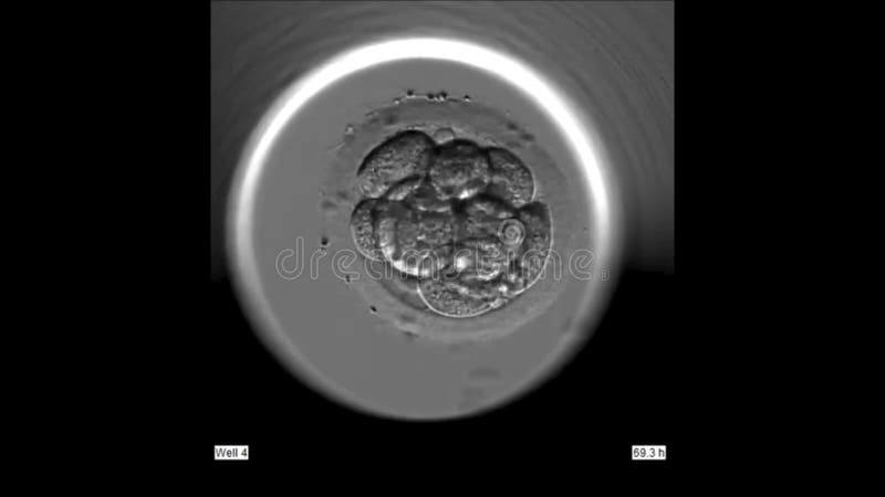 Blastocyst Formation Human Egg Fertility Cell Division. Stock Video ...