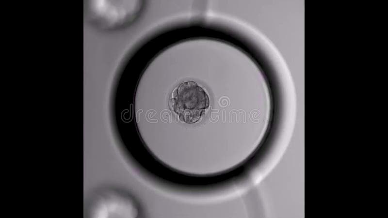 Blastocyst Formation Human Egg Fertility Cell Division Under Microscope ...