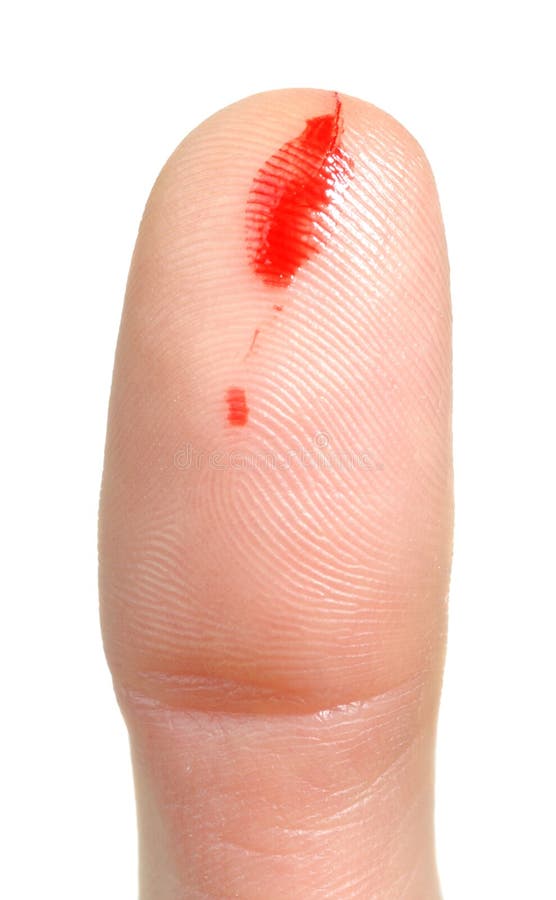 146 Bleeding Cut Finger Photos - Free & Royalty-Free Stock Photos from ...