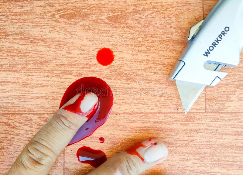 Bleeding finger from knife stock image. Image of painful - 219780551