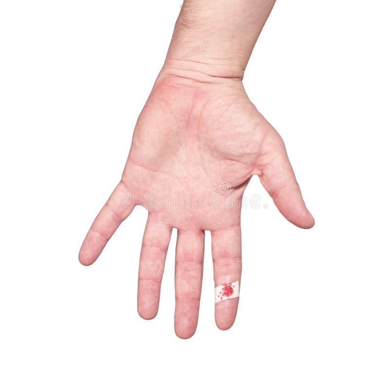 A Bleeding Finger Tip is Covered with a Bandage. Stock Photo - Image of ...