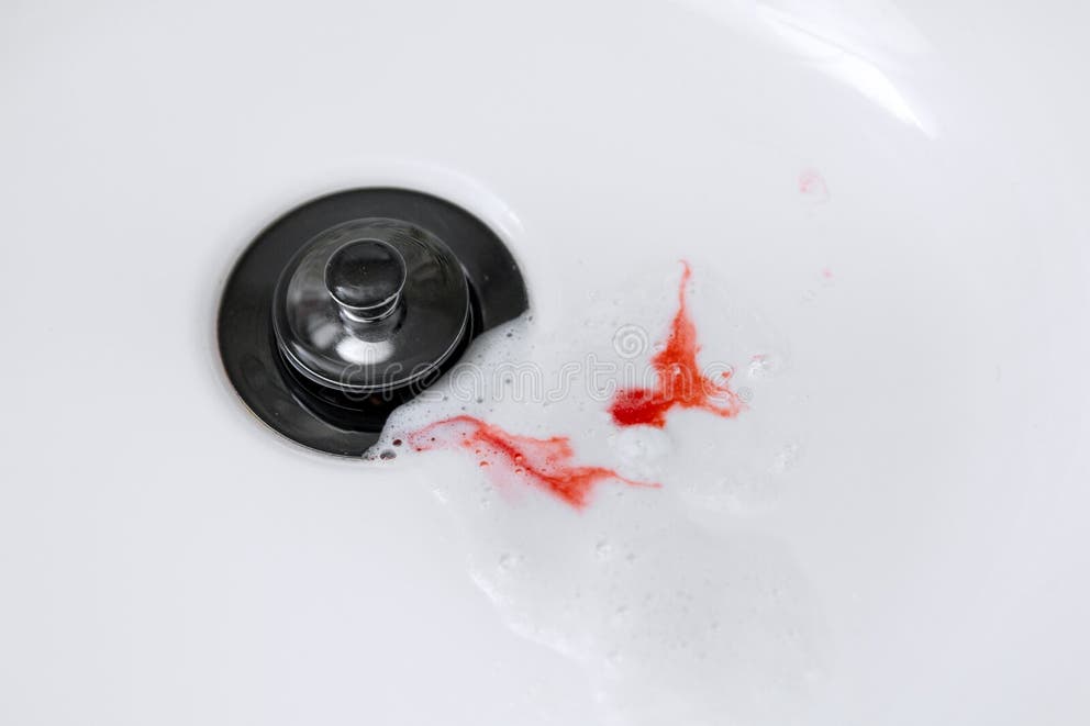 Bleeding Gums when Brushing Teeth. Toothpaste with Blood in the Sink ...