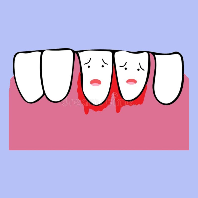 Bleeding gums crying - 1 stock illustration. Illustration of organ ...