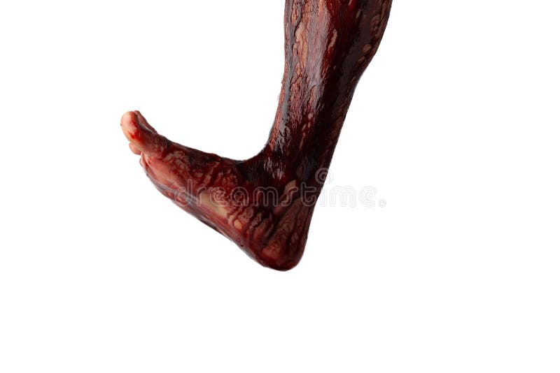 Bleeding Human Leg Isolated on White Background Stock Image - Image of ...