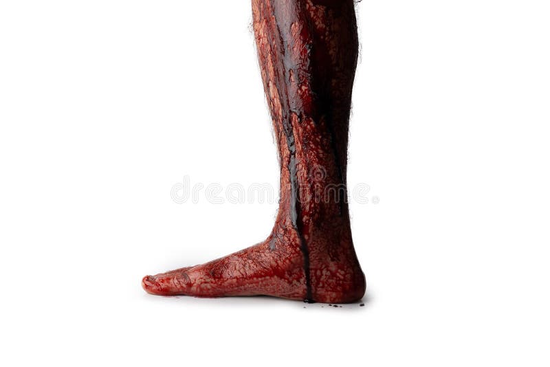 Bleeding Human Leg Isolated on White Background Stock Image - Image of ...