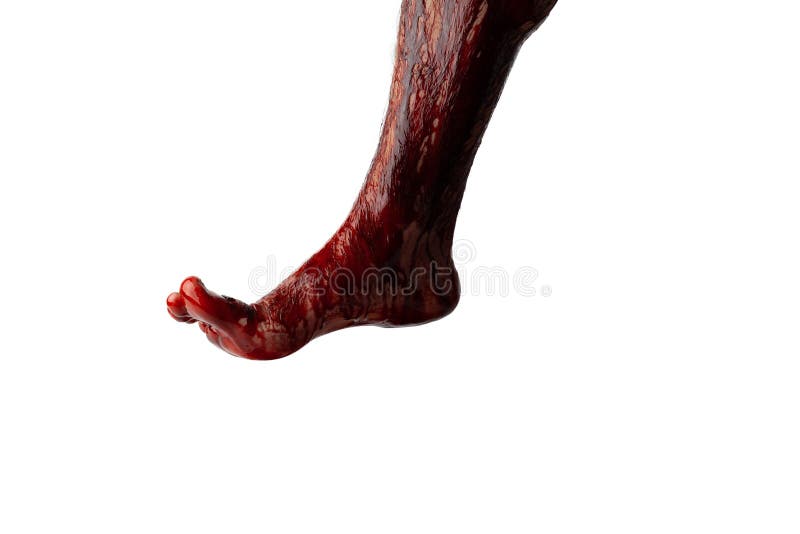 Bleeding Human Leg Isolated on White Background Stock Image - Image of ...