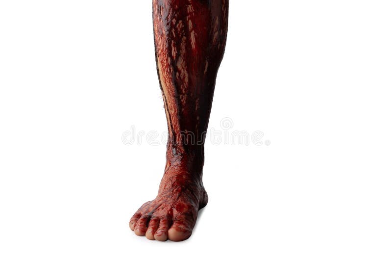 Bleeding Human Leg Isolated on White Background Stock Photo - Image of ...