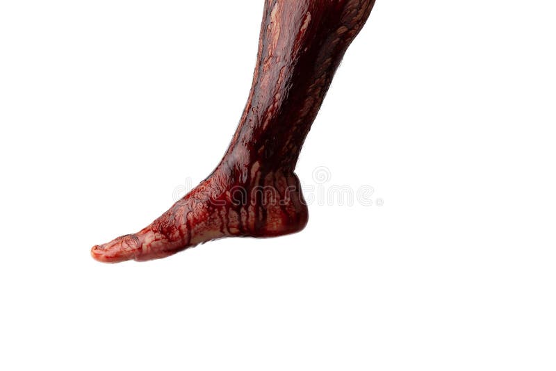 Bleeding Human Leg Isolated on White Background Stock Image - Image of ...