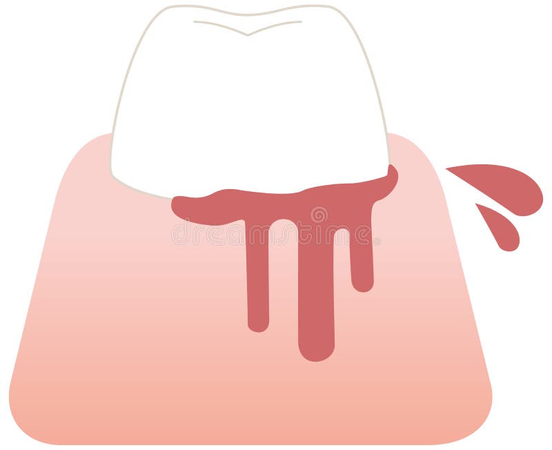 Bleeding Teeth. Vector Illustration Decorative Design Stock Vector ...