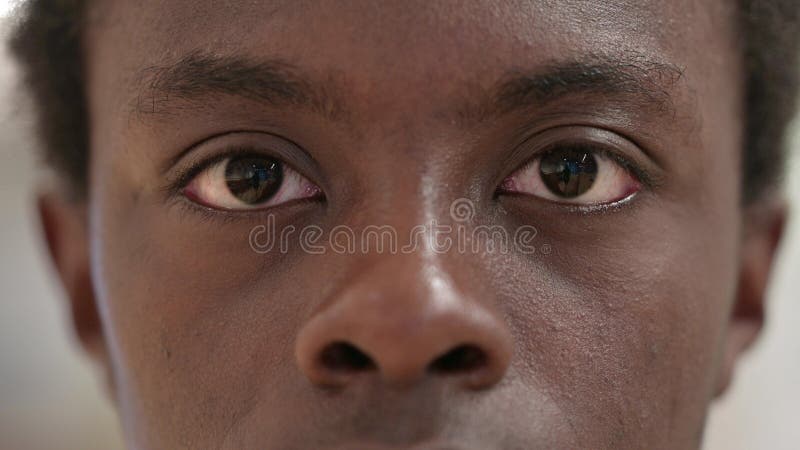 Blinking Eyes Young African Man Looking at the Camera Stock Image ...