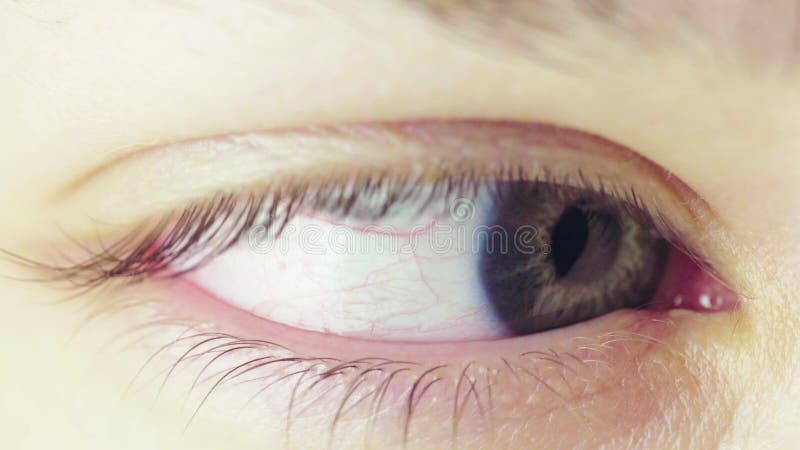 Blinking Human Eye. Constriction of the Iris in Bright Light Stock ...