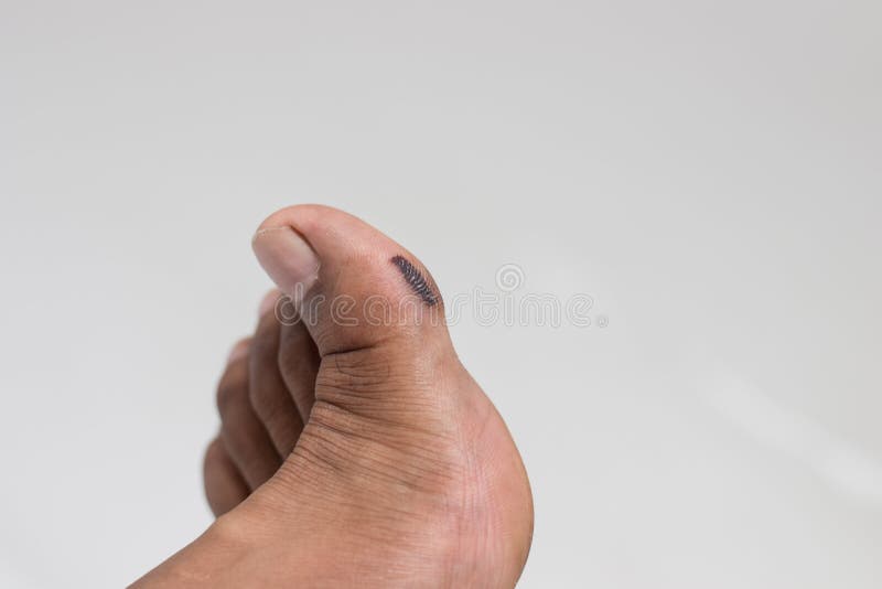 Bleeding Toe Stock Photos - Free & Royalty-Free Stock Photos from ...
