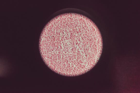 Blodbild, närbild arkivfoto. Bild av samling, blod, hälsa - 91627332