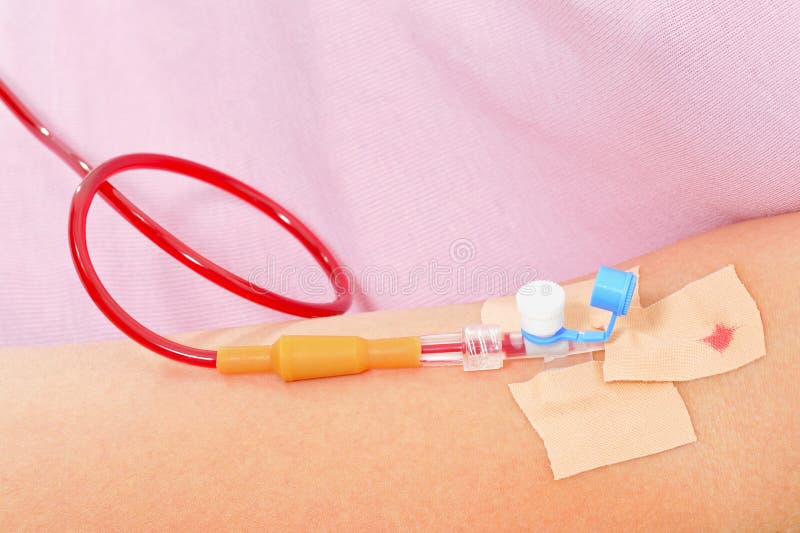 Blodtransfusion arkivfoto. Bild av kontroll, droppande - 32902080