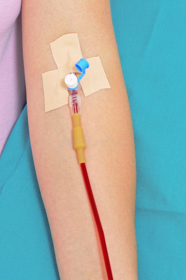 Blodtransfusion fotografering för bildbyråer. Bild av kontroll - 33103773